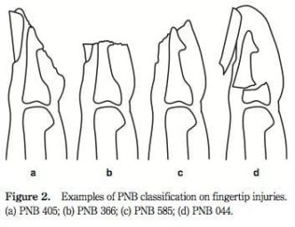 Fingertip Injury • LITFL • Bamboozler