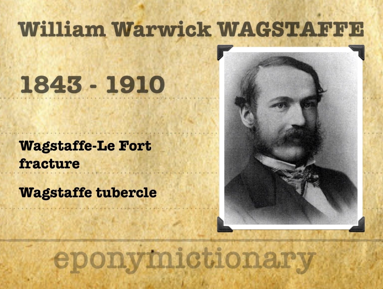 Wagstaffe Fracture Archives • LITFL