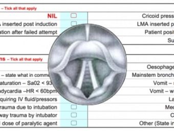Matthew Mac Partlin, Author at Life in the Fast Lane • LITFL
