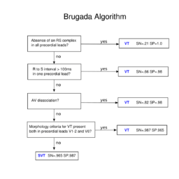 VT versus SVT • LITFL Medical Blog • ECG Library Basics
