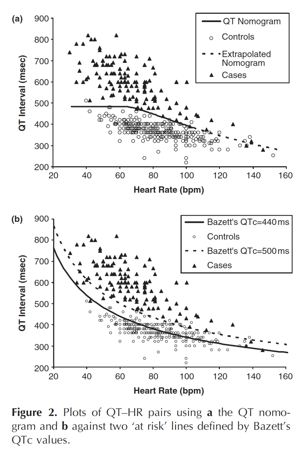 QT Interval • LITFL • ECG Library Basics