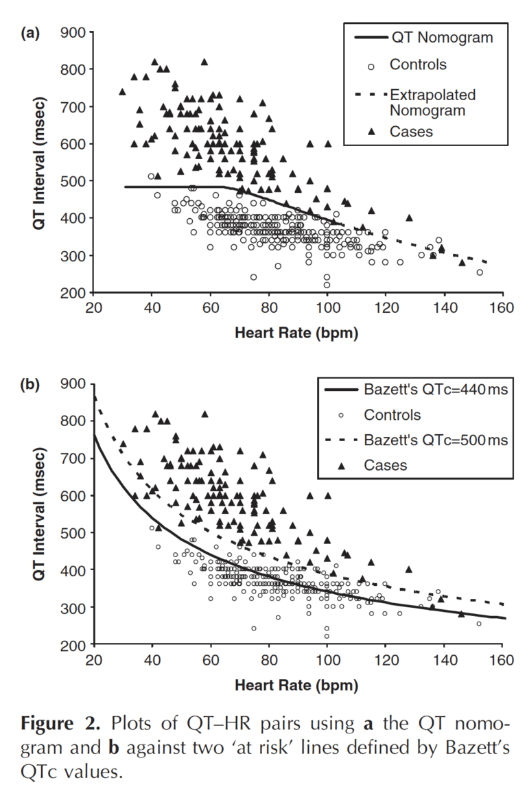 QT Interval • LITFL • ECG Library Basics