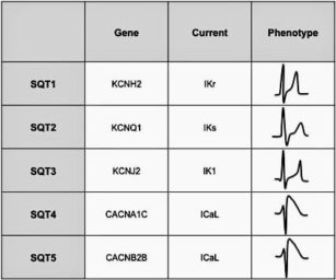 Short QT Syndrome • LITFL • ECG Library Diagnosis