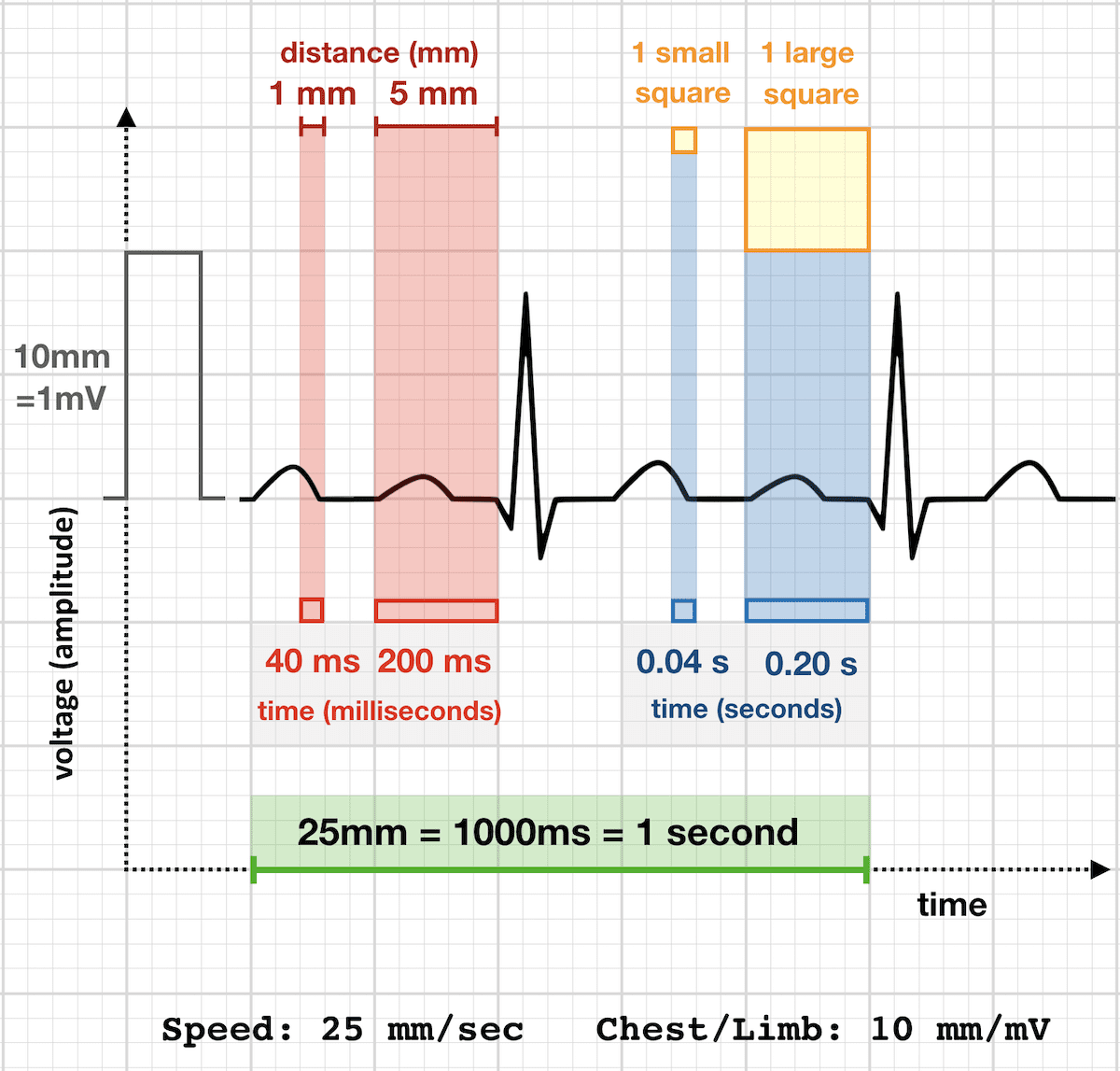  Rapid Interpretation Of EKG s An Interactive Course 