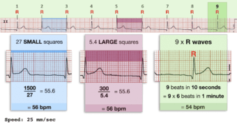 ECG Exam Template • LITFL • ECG Library Basics