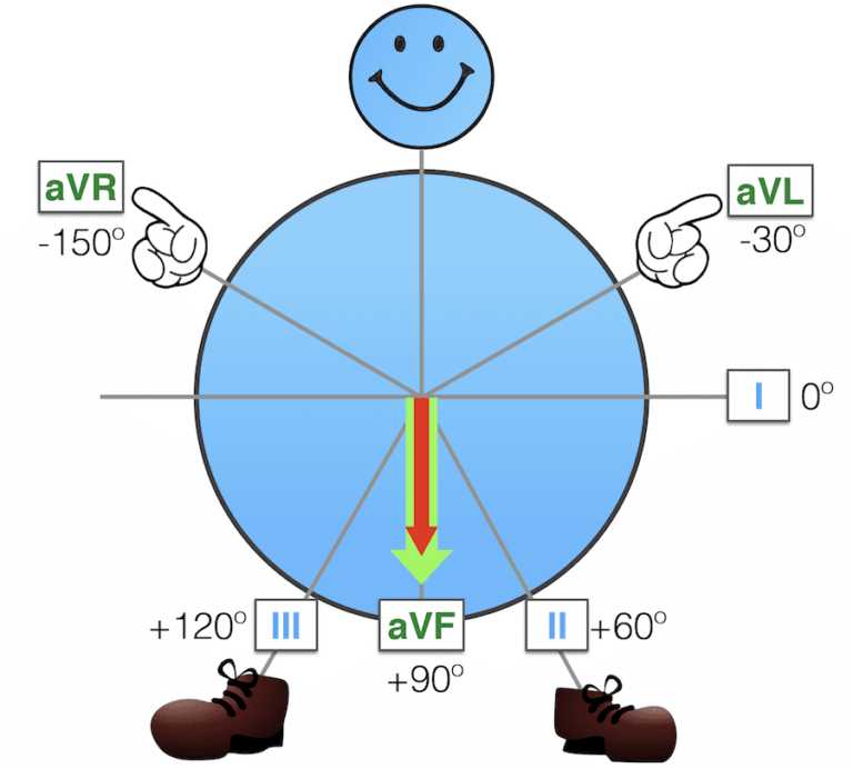 Super Axis Man SAM • LITFL • ECG Library Basics