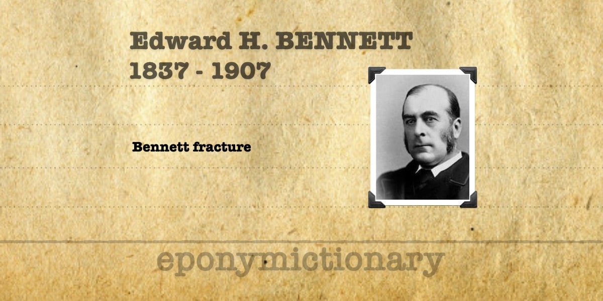 Edward H Bennett • LITFL • Medical Eponym Library