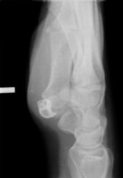 Top 10 X-Ray Foreign Bodies • LITFL • Arcanum veritas