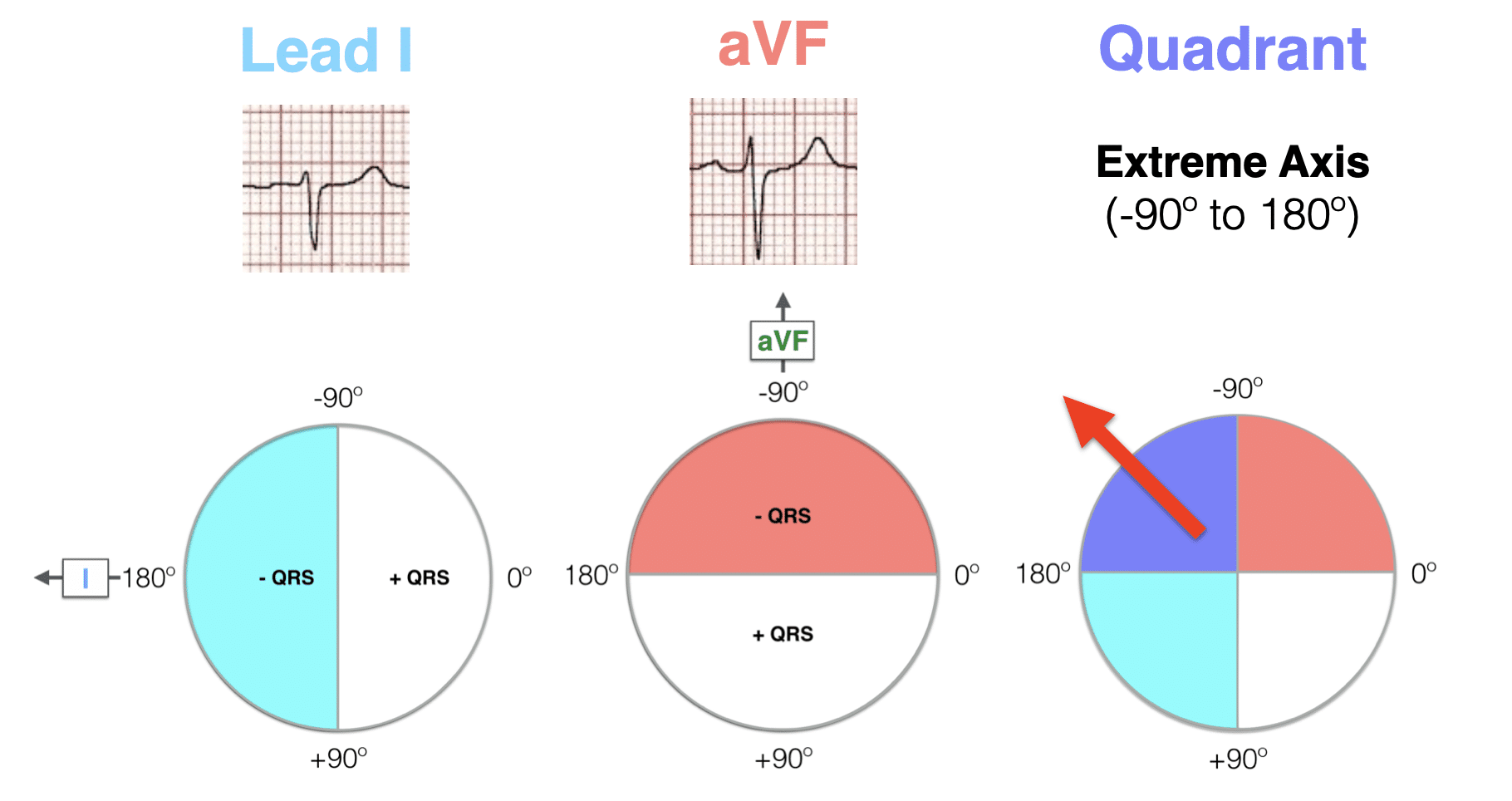 ECG Axis Interpretation LITFL ECG Library Basics ECG Axis Interpretation LITFL ECG Library Basics