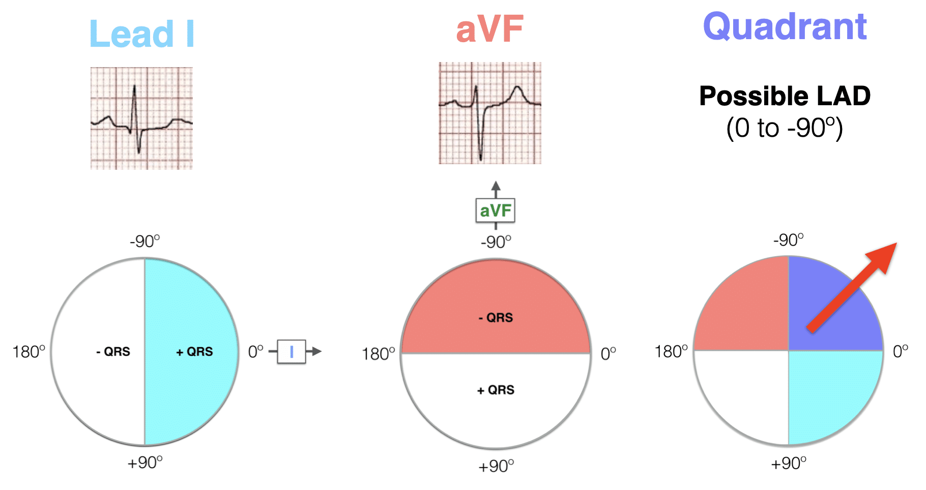 Ekg Axis