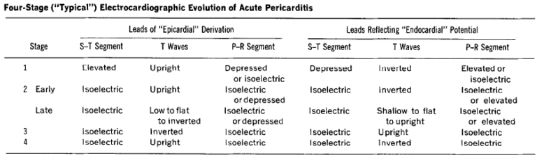 Spodick sign • LITFL • Medical Eponym Library