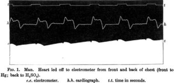 Augustus Desiré Waller • LITFL • Medical Eponym Library