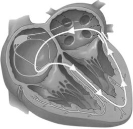 Pre-excitation syndromes • LITFL • ECG Library Diagnosis