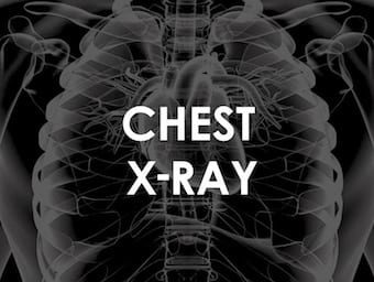 Normal CXR Archives • LITFL