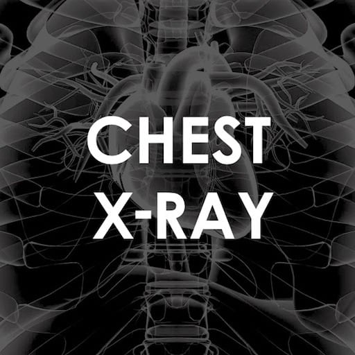 DRSABCDE Of CXR Interpretation LITFL Examination Medicine