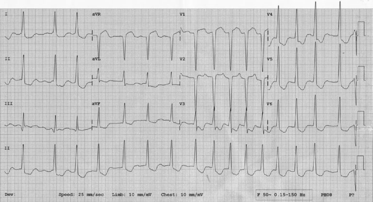 Cardiac Megacode • LITFL • Clinical Cases Curveball