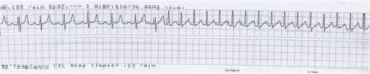 Risky Rhythyms • LITFL • Clinical Cases ECG Exigency