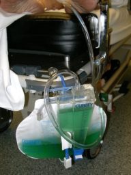 How Green is my urine • LITFL • Clinical Cases Unusual Urine