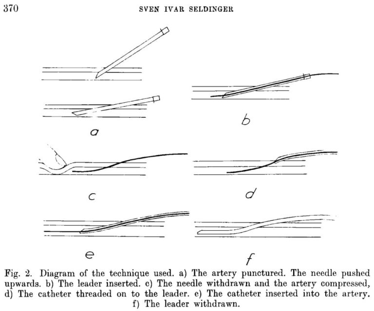 Sven-Ivar Seldinger • LITFL • Medical Eponym Library