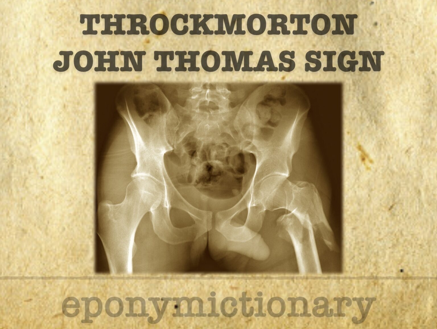 Roy-Camille sign Archives • LITFL