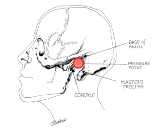 Laryngospasm • LITFL Medical Blog • CCC Ventilation