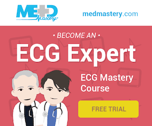 Epsilon Wave • LITFL Medical Blog • ECG Library Basics