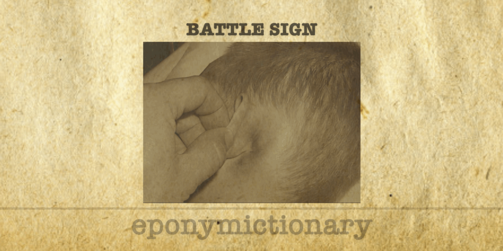 Battle Sign • LITFL • Medical Eponym Library