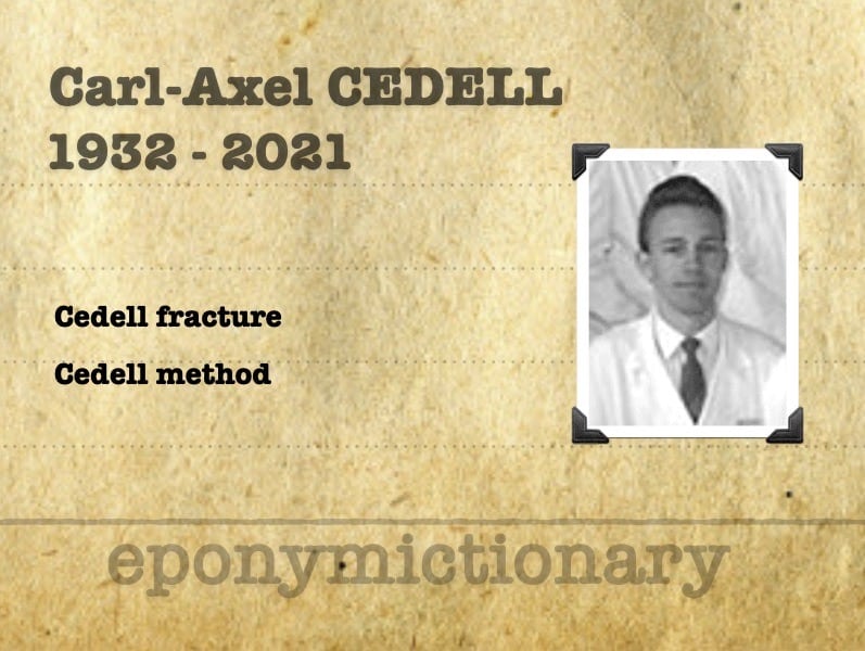 Cedell fracture Archives • LITFL