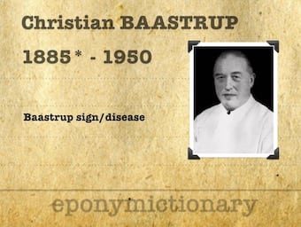 Baastrup disease Archives • LITFL