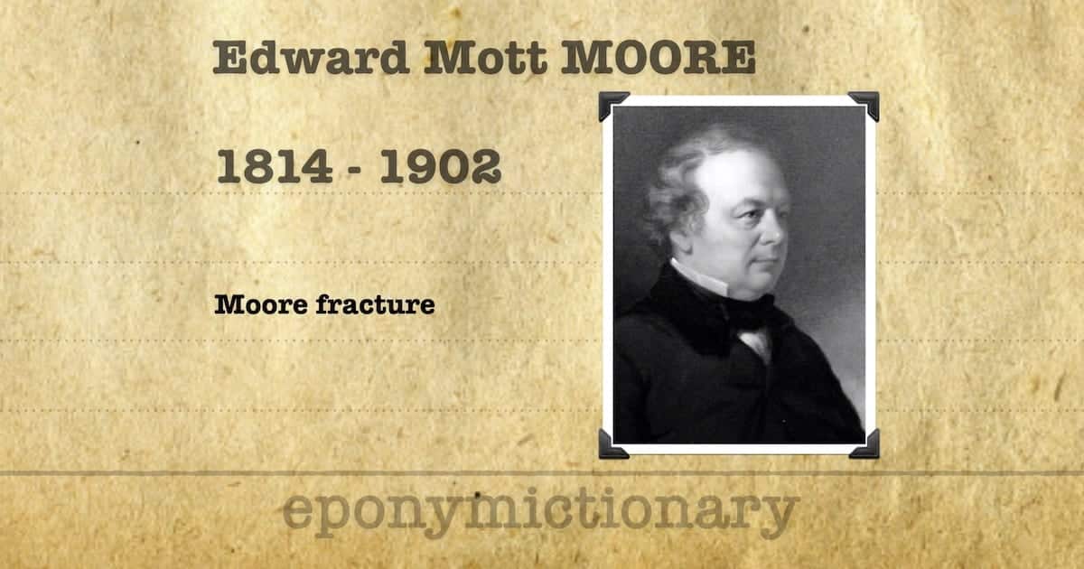 Moore fracture • LITFL Medical Blog • Medical Eponym Library