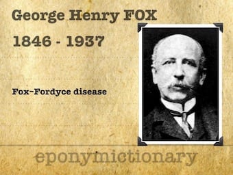 george henry fox Archives • LITFL