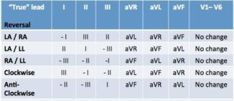 ECG Limb Lead Reversal • LITFL • ECG Library Diagnosis