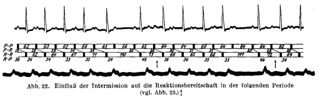 Woldemar Mobitz • LITFL Medical Blog • Medical Eponym Library