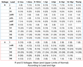 Paediatric ECG: Stepwise approach • LITFL • ECG Library Diagnosis