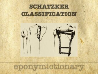 Tibial plateau fracture Archives • LITFL