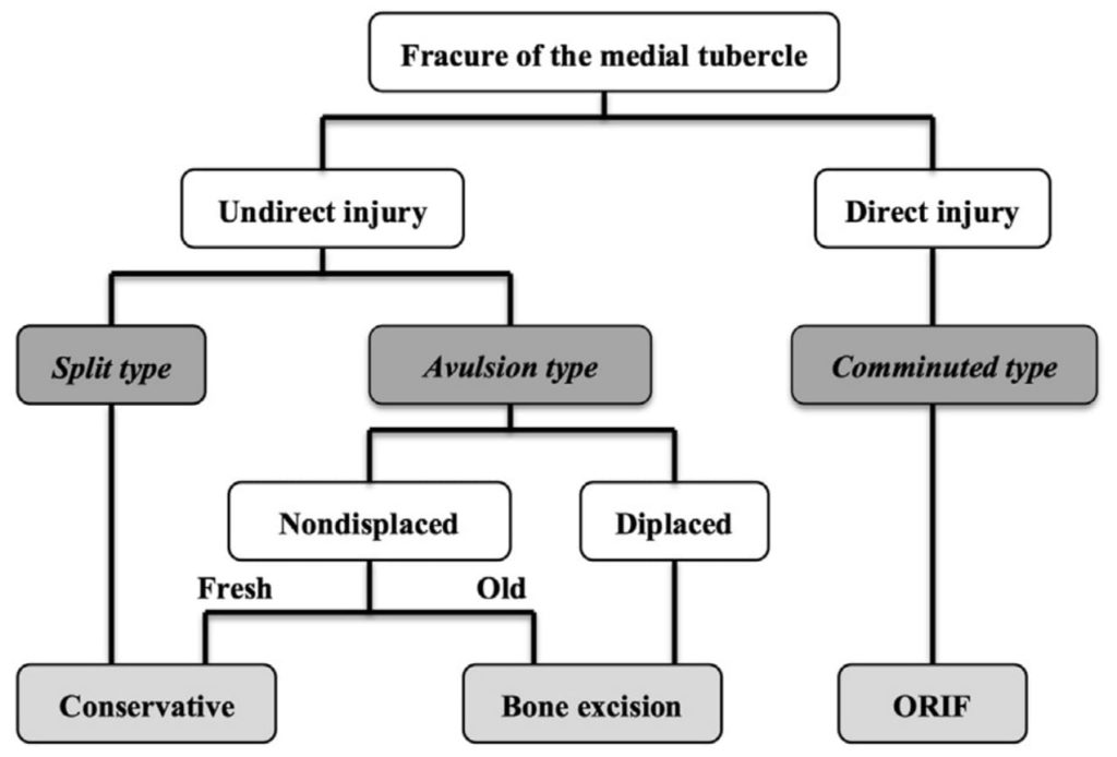 Cedell fracture • LITFL • Medical Eponym Library