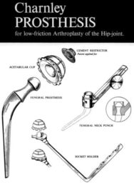 Sir John Charnley • LITFL • Medical Eponym Library