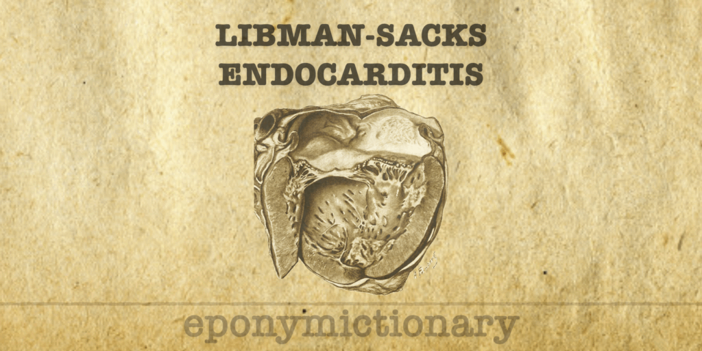 Libman-Sacks endocarditis • LITFL • Medical Eponym Library
