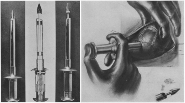 Claude Beck • LITFL • Medical Eponym Library