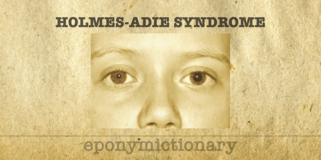Adie syndrome • LITFL Medical Blog • Medical Eponym Library