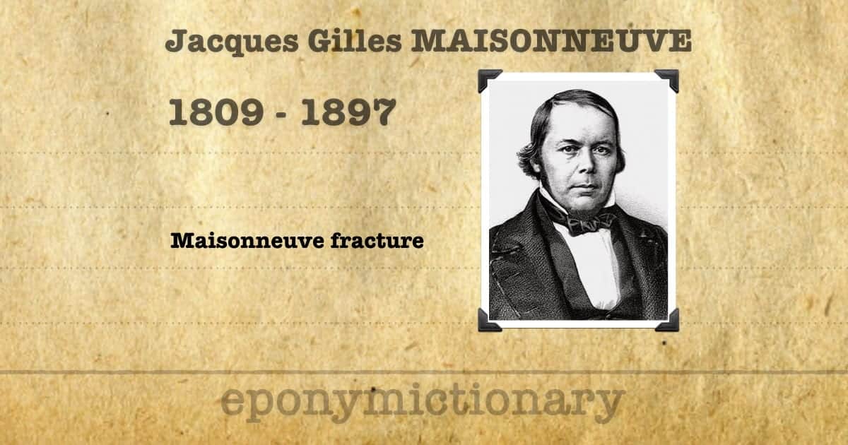 Jacques Gilles Maisonneuve • LITFL • Medical Eponym Library