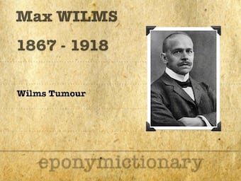 Wilms Tumour Archives • LITFL
