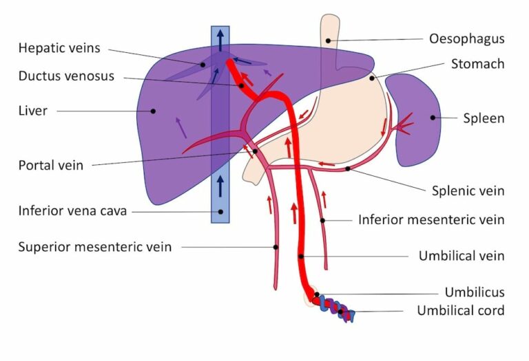 Ultrasound Case 045 • LITFL • POCUS Self-Assessment Quiz