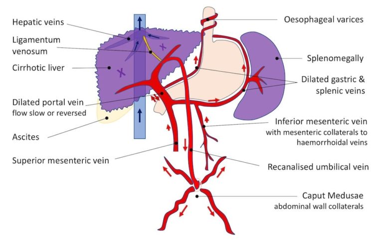 Ultrasound Case 045 • LITFL • POCUS Self-Assessment Quiz