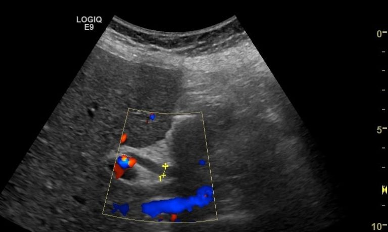 Ultrasound Case 049 • LITFL • POCUS Self-Assessment Quiz