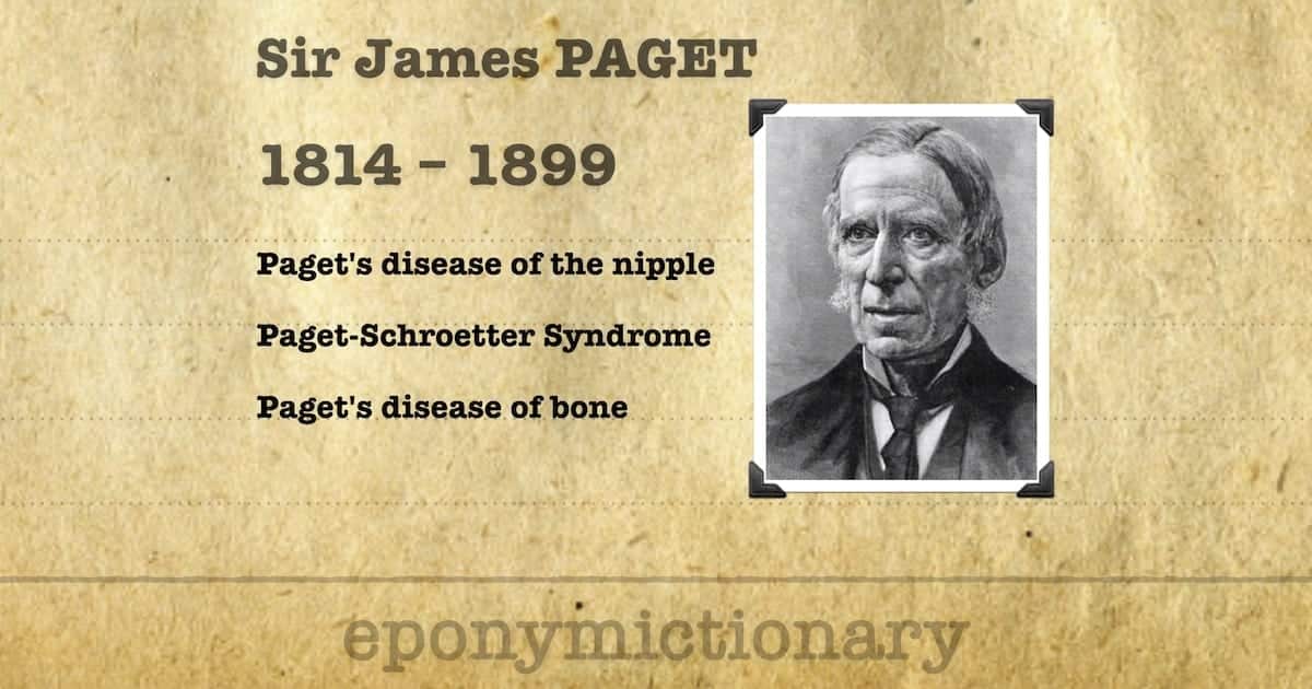 James Paget • LITFL Medical Blog • Medical Eponym Library