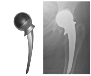 Frederick Roeck Thompson • LITFL • Medical Eponym Library