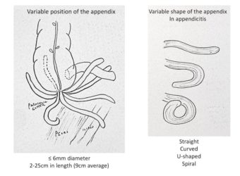 Ultrasound Case 083 • LITFL • POCUS Self-Assessment Quiz