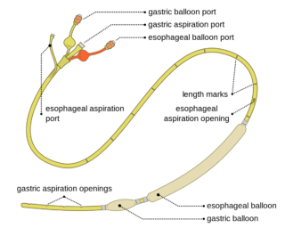 Sengstaken–Blakemore and Minnesota Tubes • LITFL • CCC Equipment