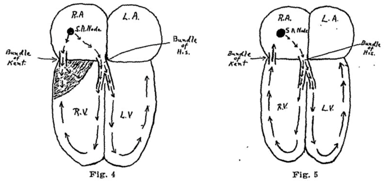 History of the Electrocardiogram • LITFL • Medical Eponym Library